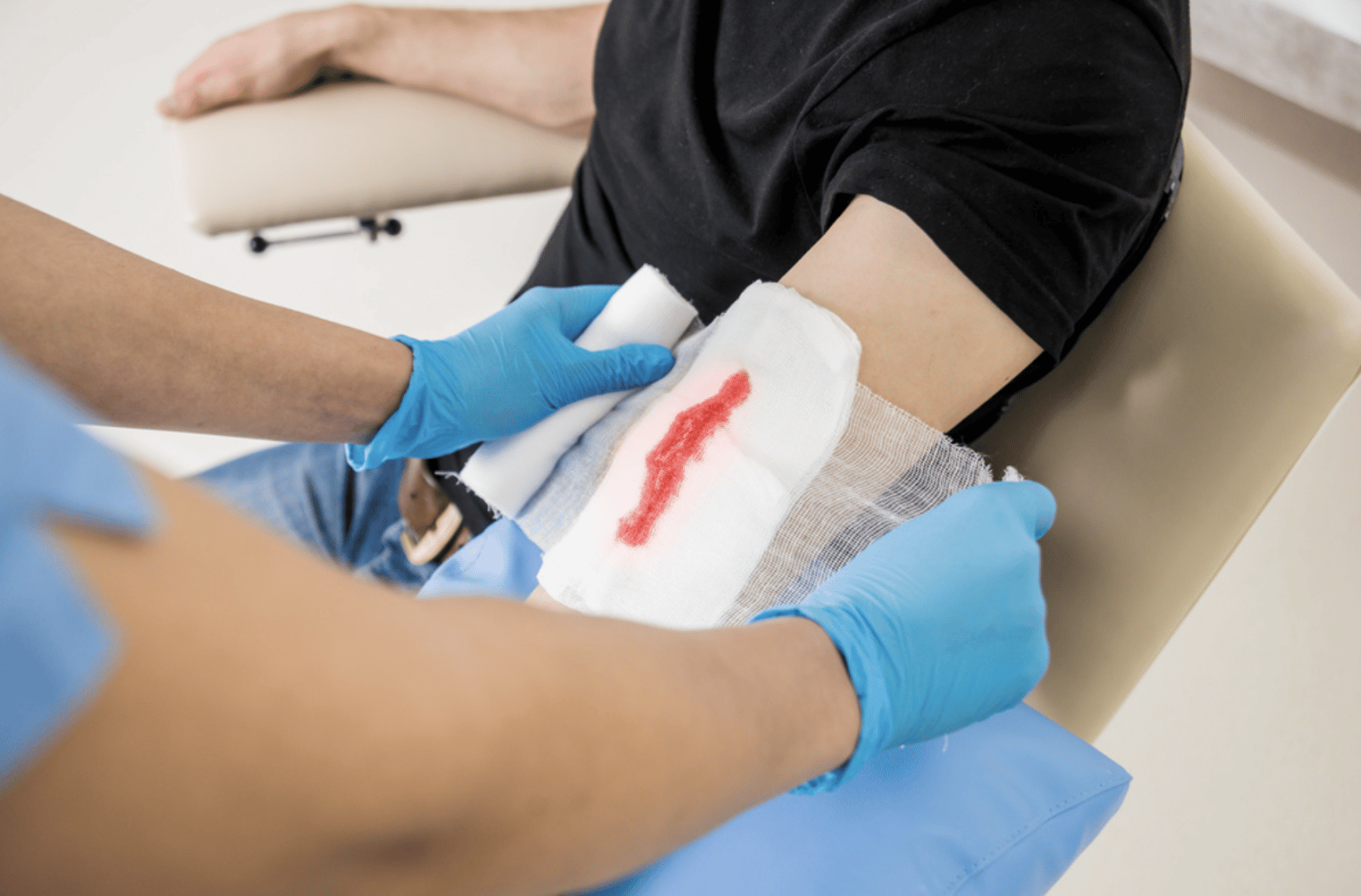 How To Treat Deep Cuts And Wounds
