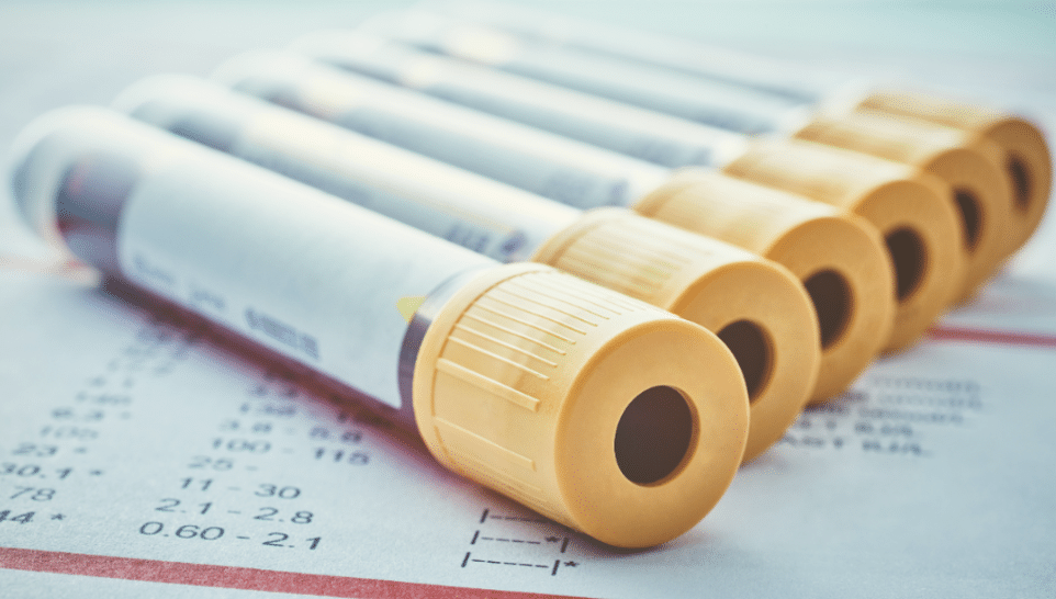 Understanding Common Blood Tests: What You Should Know